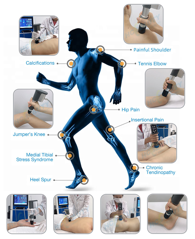 Double Focused Shock Wave Relief Pain Physical Therapy Shockwave ...