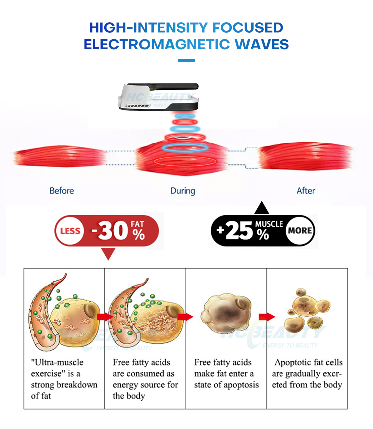 Em Slim Beauty Machine Emsculpt Muscle Sculpting