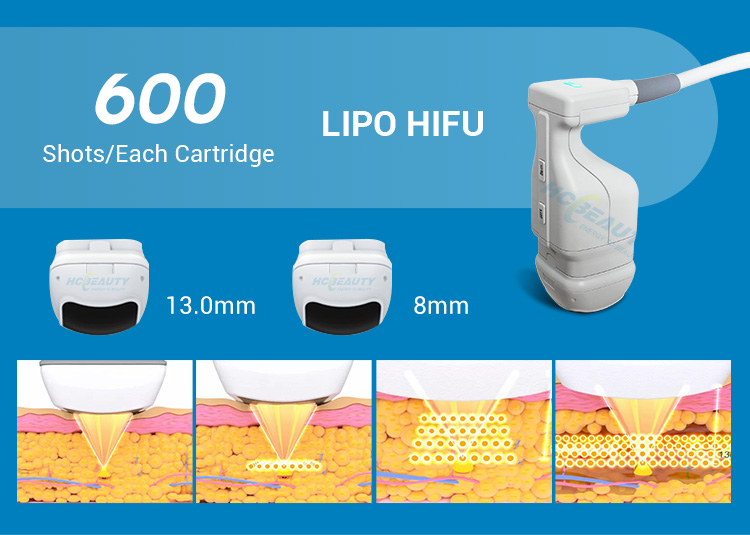 New Ice Hifu Machine for Face Body Vaginal